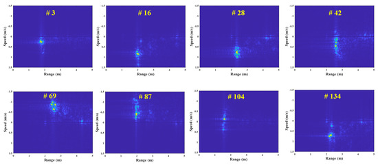 Reconstruction of Range-Doppler Map Corrupted by FMCW Radar ...