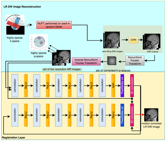 Diffusion Weighted Imaging Super-Resolution Algorithm for Highly Sparse Raw Data Sequences