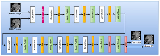 Diffusion Weighted Imaging Super-Resolution Algorithm for Highly Sparse Raw Data Sequences