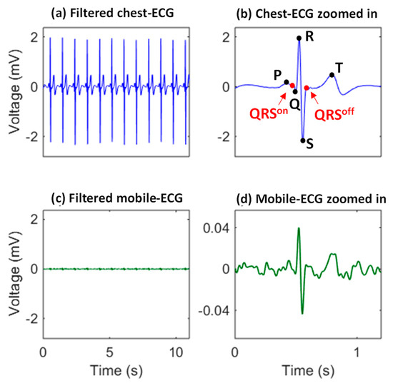 Sensors | Free Full-Text | Machine Learning Electrocardiogram for ...