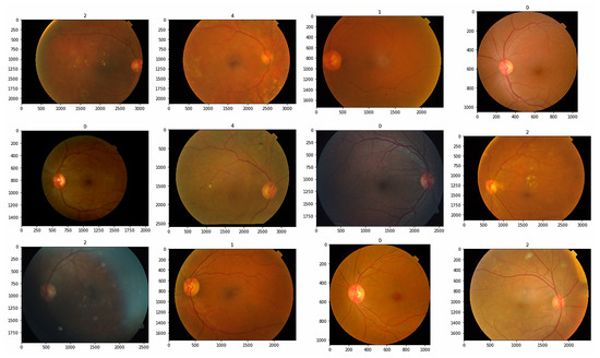 Using Deep Learning Architectures for Detection and Classification of ...