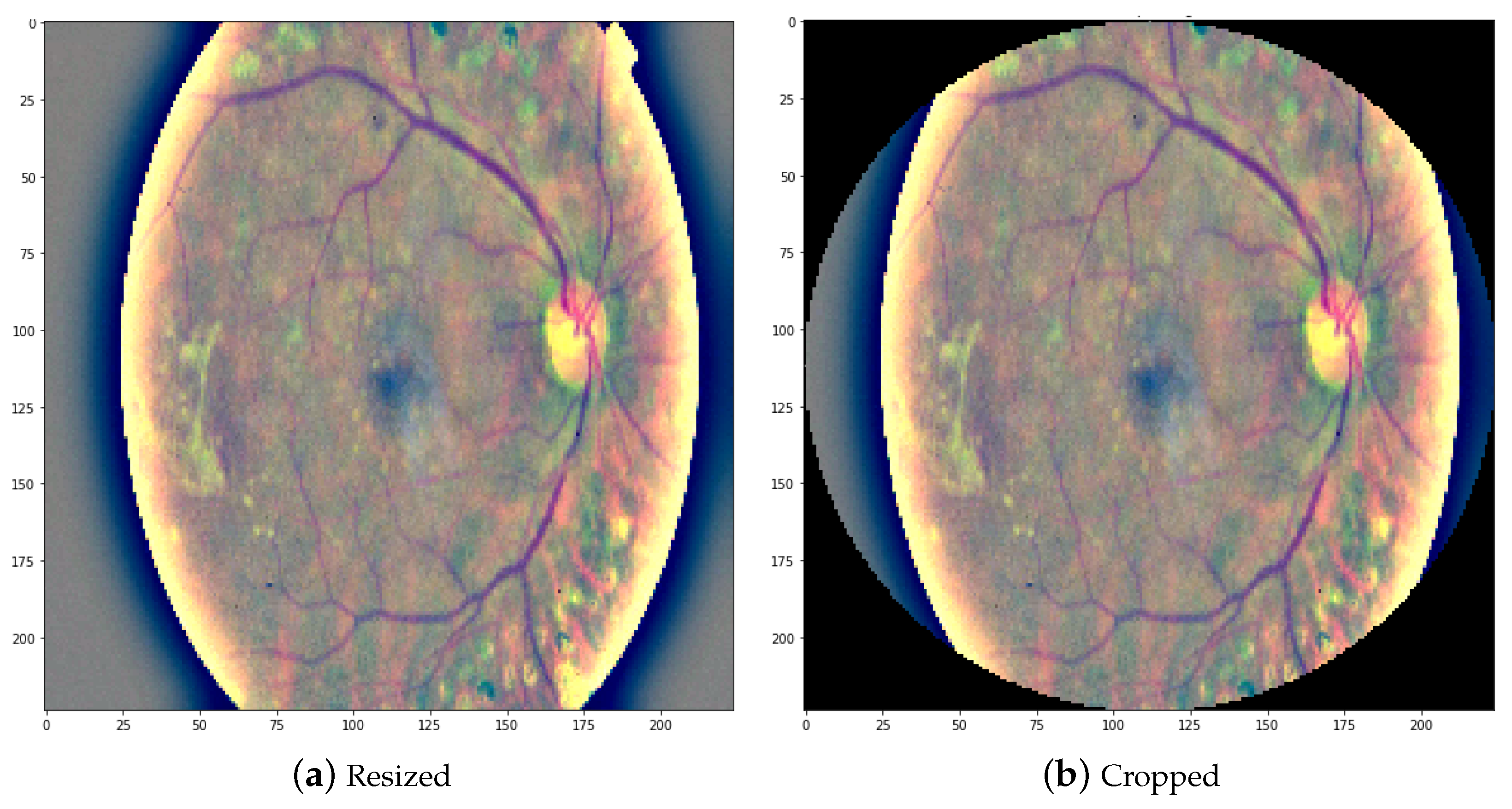 Using Deep Learning Architectures for Detection and Classification of Diabetic Retinopathy