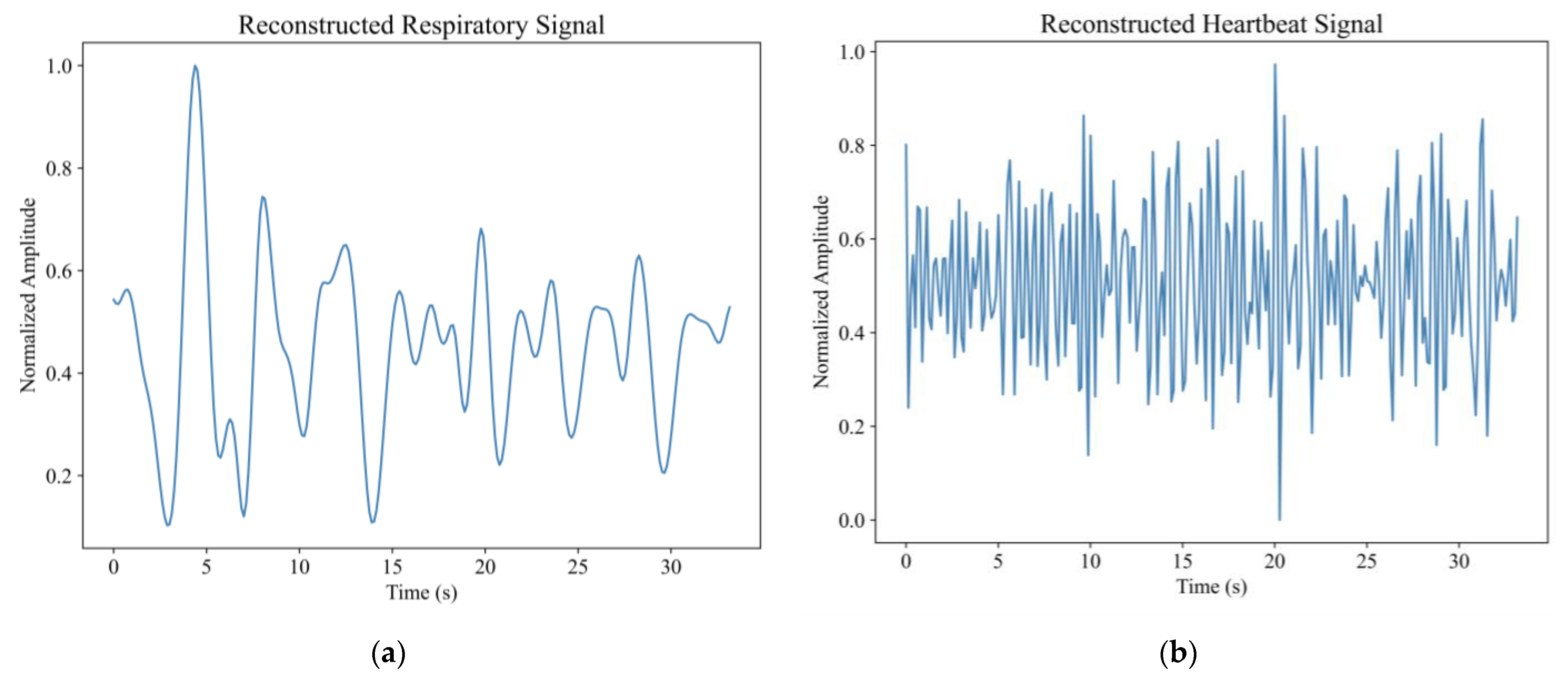 A Multi-Target Localization and Vital Sign Detection Method Using Ultra-Wide Band Radar