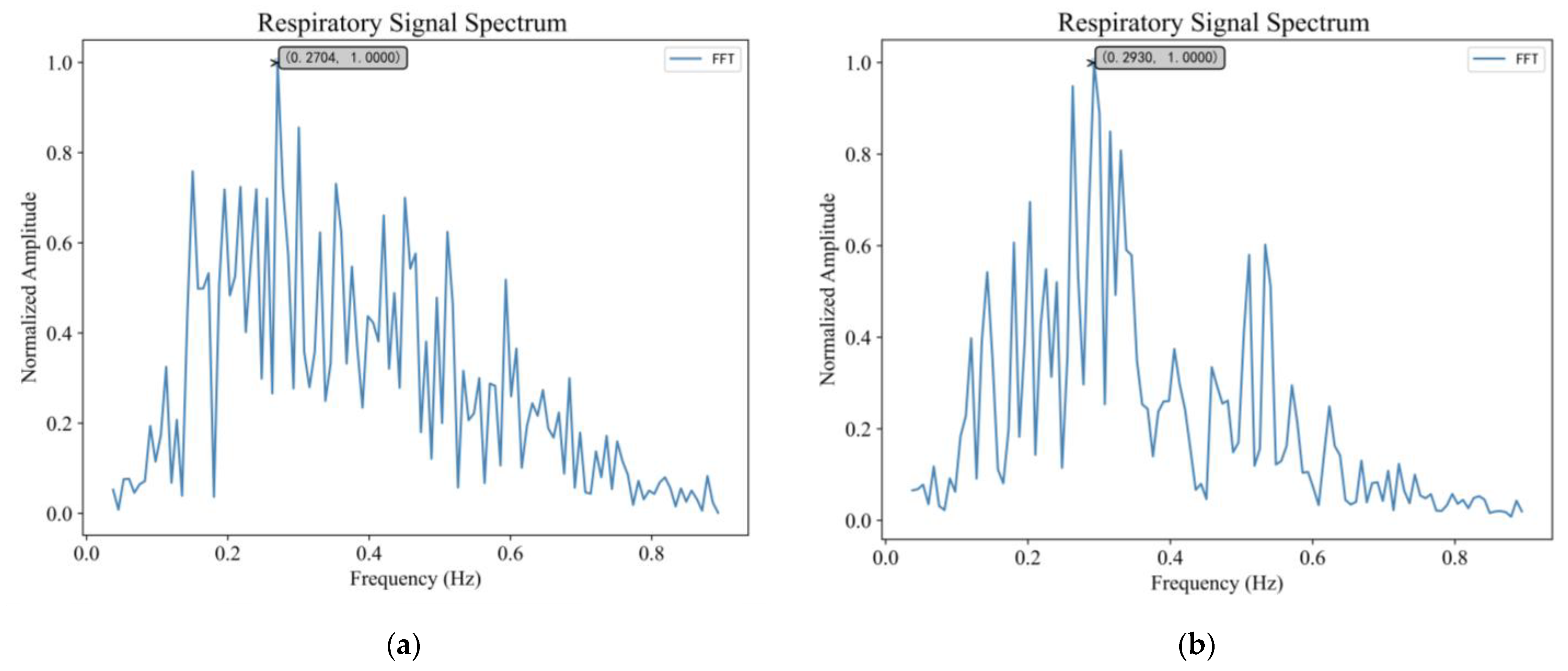 A Multi-Target Localization and Vital Sign Detection Method Using Ultra ...