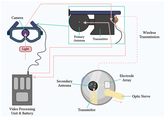 Retinal Prostheses: Engineering and Clinical Perspectives for Vision Restoration