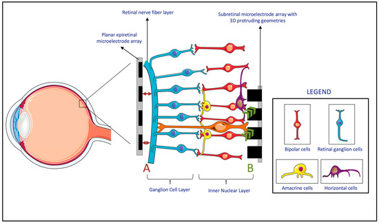Retinal Prostheses: Engineering and Clinical Perspectives for Vision ...