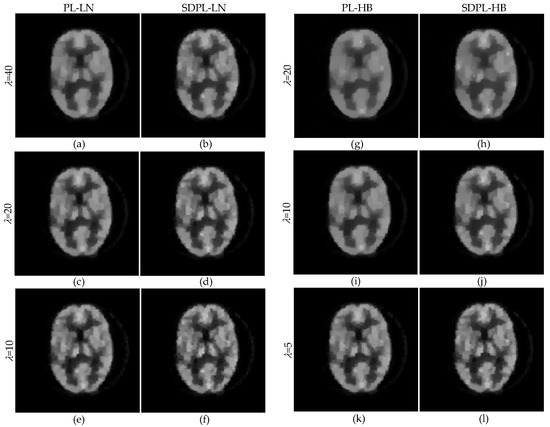 Similarity-Driven Fine-Tuning Methods for Regularization Parameter Optimization in PET Image ...