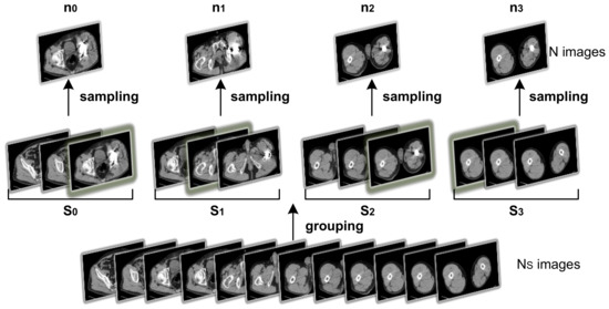 HGT: A Hierarchical GCN-Based Transformer for Multimodal Periprosthetic ...