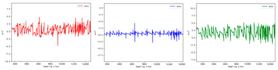 Research on Six-Axis Sensor-Based Step-Counting Algorithm for Grazing Sheep