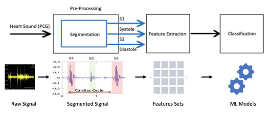 A New Method for Heart Disease Detection: Long Short-Term Feature ...