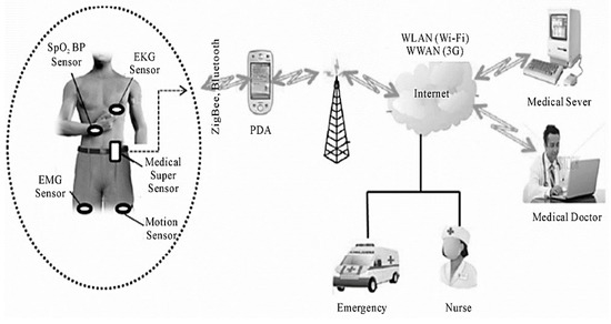 Remote Patient Activity Monitoring System by Integrating IoT Sensors ...