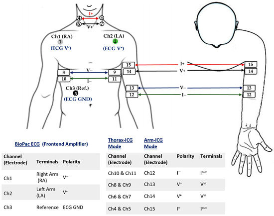 Sensors | Free Full-Text | Robust Arm Impedocardiography Signal Quality ...
