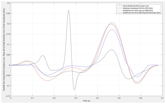 Sensors | Free Full-Text | Robust Arm Impedocardiography Signal Quality Enhancement Using ...