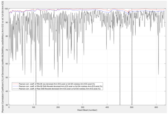 Sensors | Free Full-Text | Robust Arm Impedocardiography Signal Quality ...