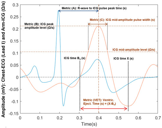 Sensors | Free Full-Text | Robust Arm Impedocardiography Signal Quality Enhancement Using ...