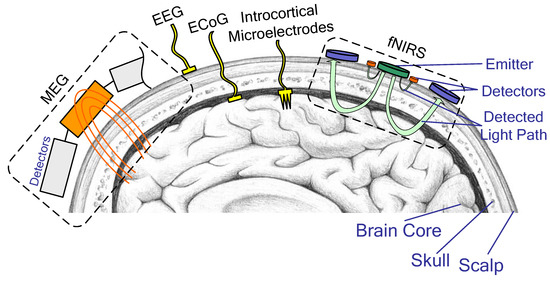 Sensors | Free Full-Text | State-of-the-Art on Brain-Computer Interface Technology