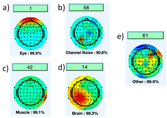 Classifying Unstable and Stable Walking Patterns Using Electroencephalography Signals and ...