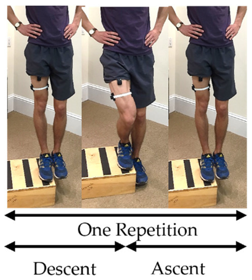Assessing Quadriceps Muscle Contraction Using a Novel Surface ...