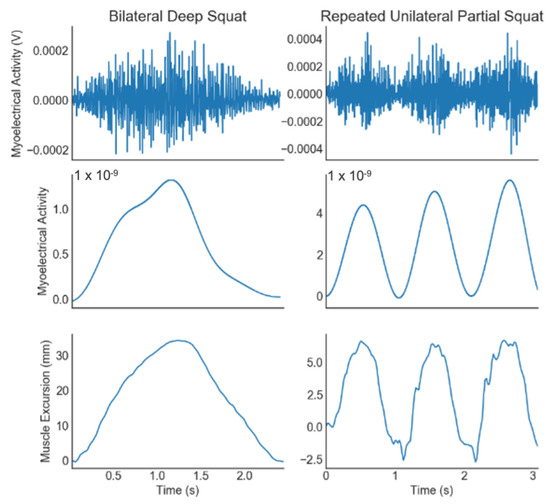 Assessing Quadriceps Muscle Contraction Using a Novel Surface ...