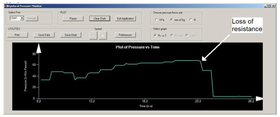 Recent Advances in Smart Epidural Spinal Needles