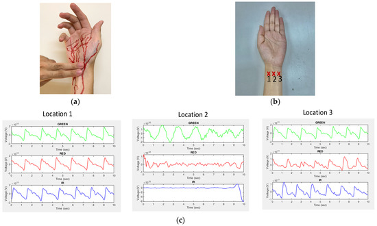 Precision Heart Rate Estimation Using a PPG Sensor Patch Equipped with ...