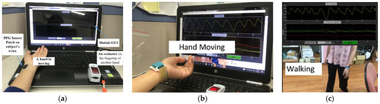 Precision Heart Rate Estimation Using A Ppg Sensor Patch Equipped With