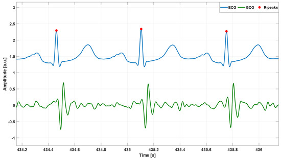 Heartbeat Detection in Gyrocardiography Signals without Concurrent ECG ...