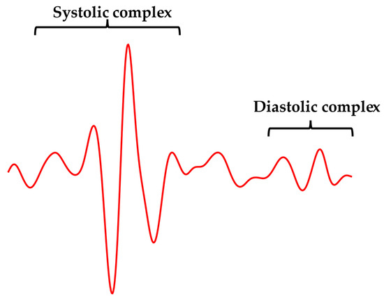 Heartbeat Detection in Gyrocardiography Signals without Concurrent ECG ...