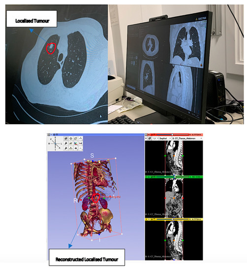 Augmented Reality (AR) for Surgical Robotic and Autonomous Systems ...