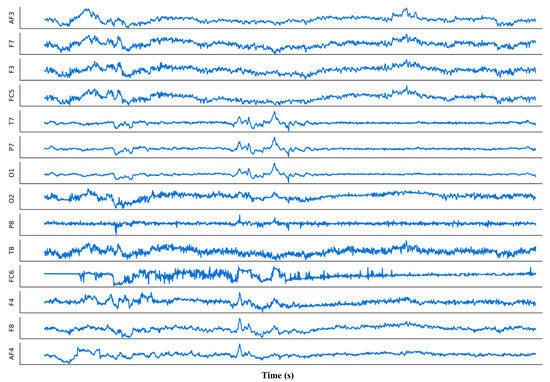 Electroencephalography Signal Processing: A Comprehensive Review and Analysis of Methods and ...