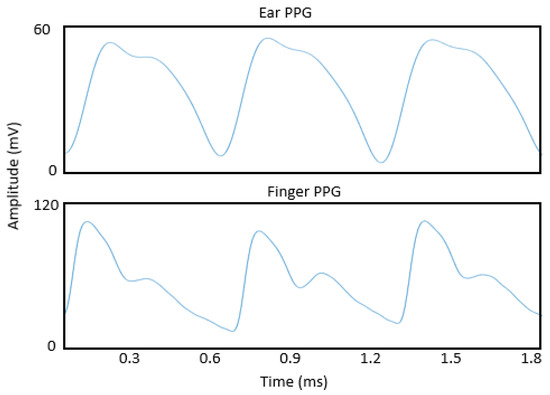 The Principles of Hearable Photoplethysmography Analysis and ...