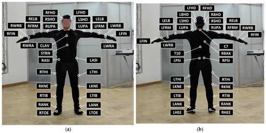 Automated Gait Analysis Based on a Marker-Free Pose Estimation Model