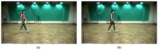 Automated Gait Analysis Based on a Marker-Free Pose Estimation Model