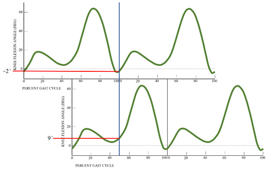 Walking Trajectory Estimation Using Multi-Sensor Fusion and a ...