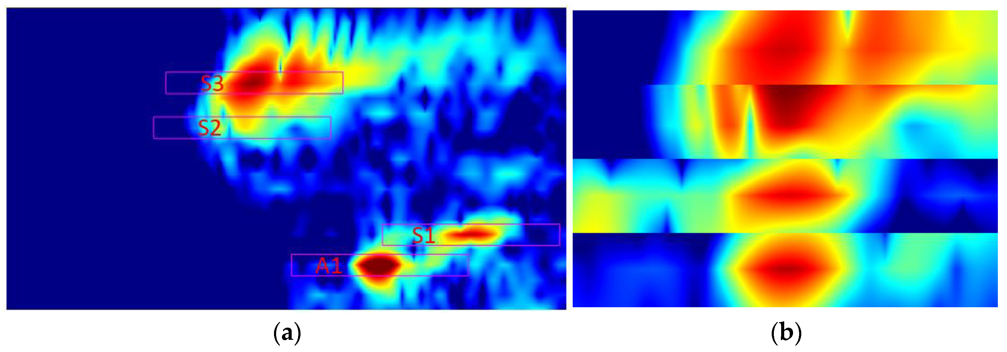Detection and Classification of Uniform and Concentrated Wall-Thinning ...