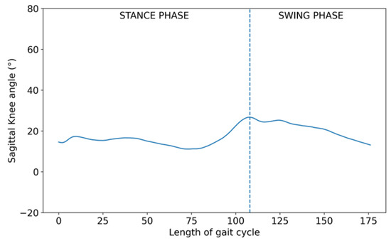 Clinical Gait Analysis: Characterizing Normal Gait and Pathological ...