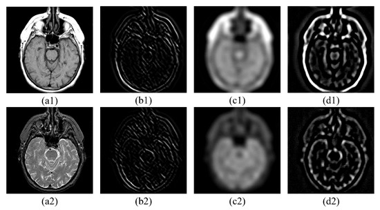 TDFusion: When Tensor Decomposition Meets Medical Image Fusion in the ...