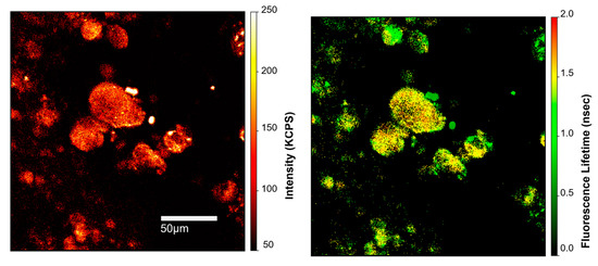 Two-Photon Excited Fluorescence Lifetime Imaging of Tetracycline ...