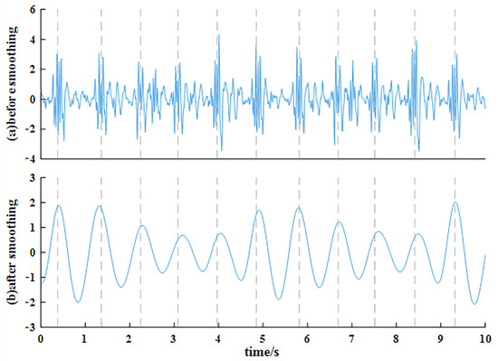 A Real-Time Evaluation Algorithm for Noncontact Heart Rate Variability ...