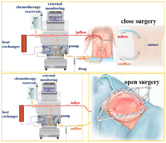 The Design of an Automatic Temperature Compensation System through ...