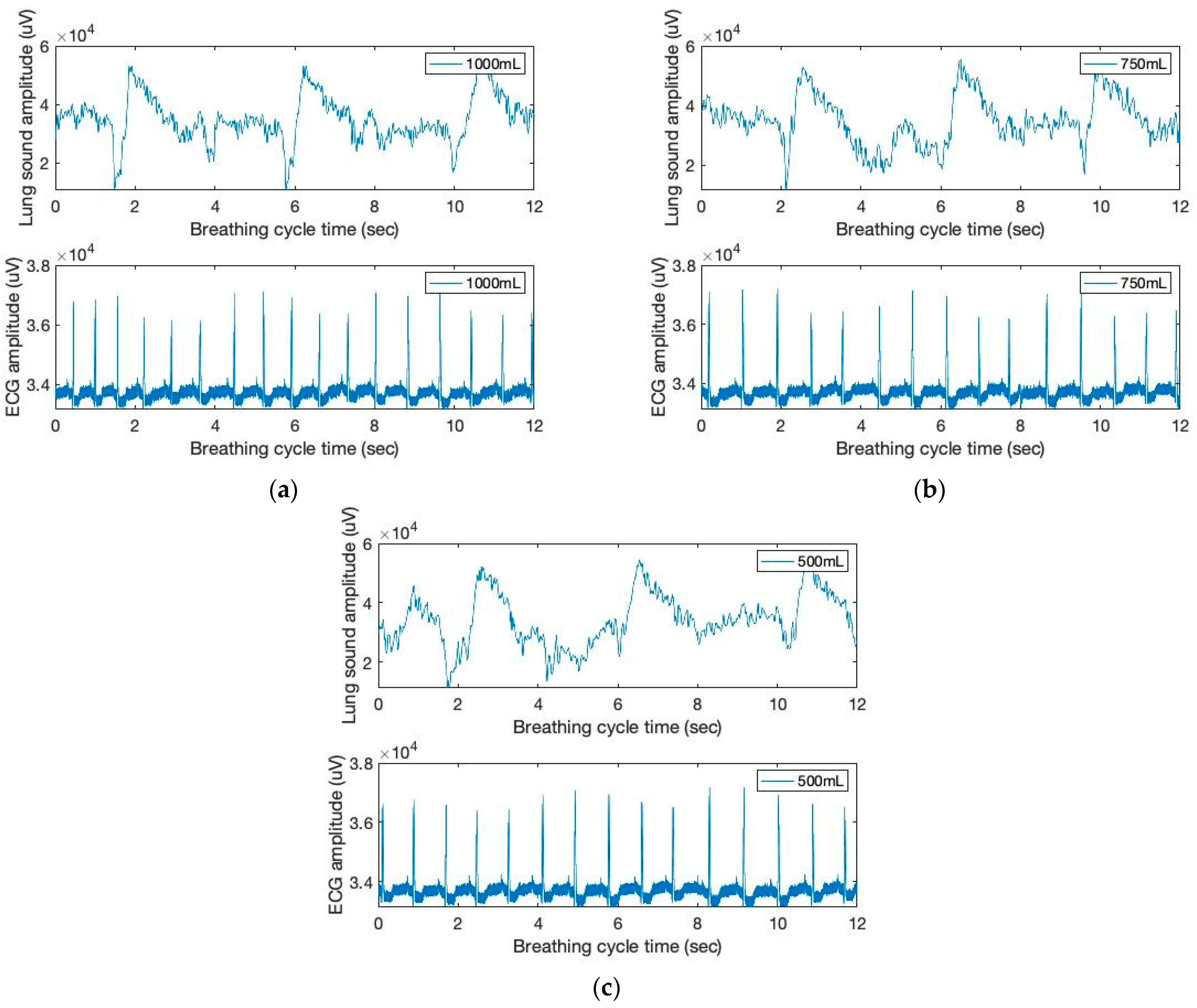 A Wearable Multimodal Wireless Sensing System for Respiratory ...