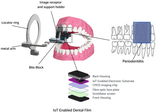 Teeth Lesion Detection Using Deep Learning and the Internet of Things ...