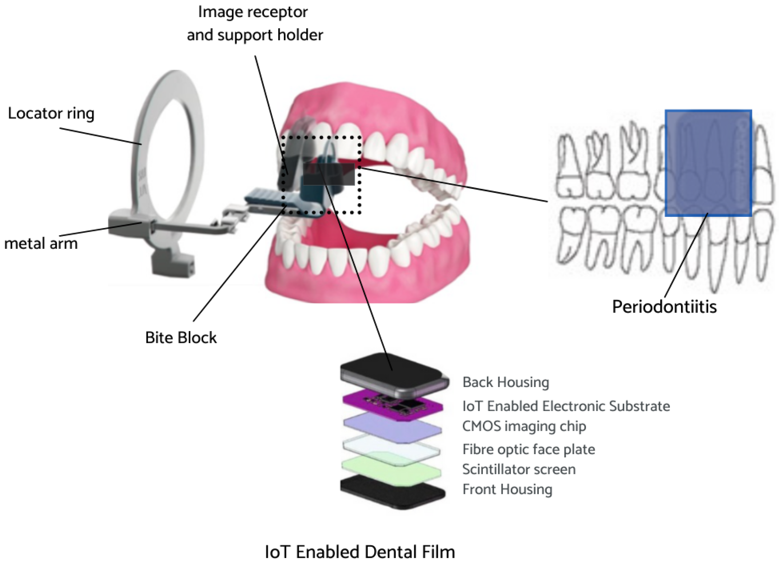 Teeth Lesion Detection Using Deep Learning and the Internet of Things ...
