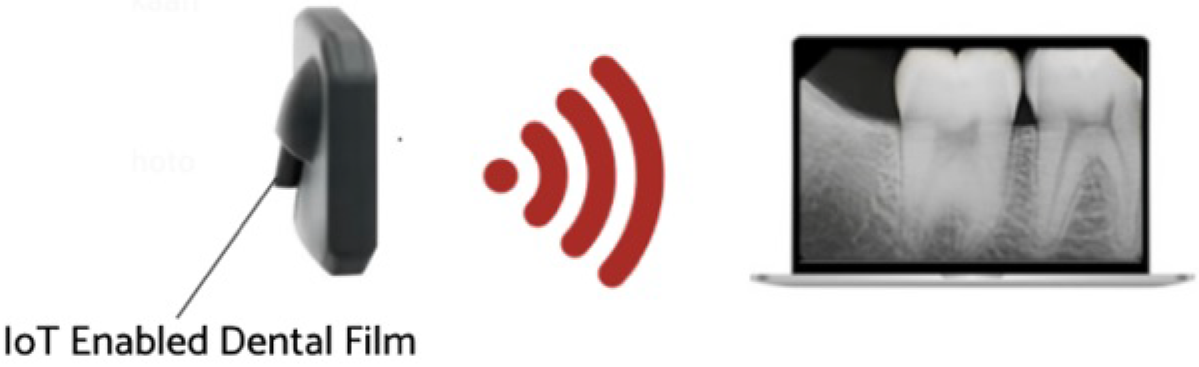 Teeth Lesion Detection Using Deep Learning and the Internet of Things ...