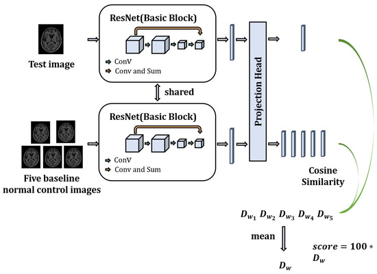 The Objective Dementia Severity Scale Based on MRI with Contrastive ...