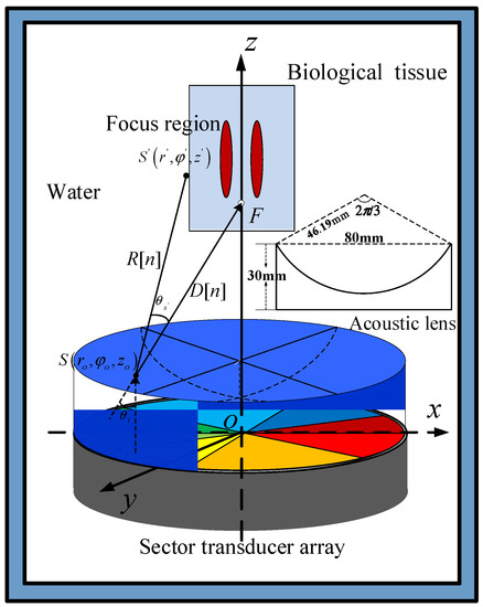 Acoustic Forceps Based on Focused Acoustic Vortices with Different Topological Charges
