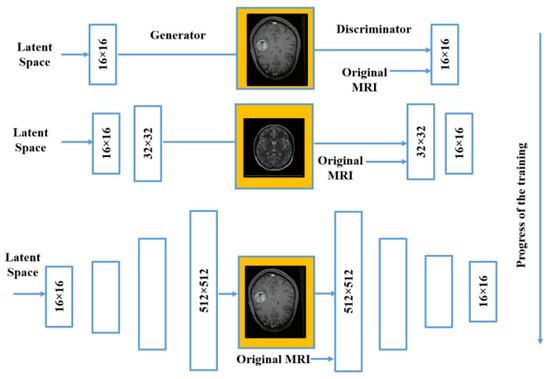 An Augmented Modulated Deep Learning Based Intelligent Predictive Model for Brain Tumor ...