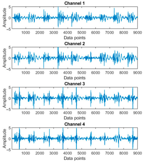 Mechanomyography Signal Pattern Recognition of Knee and Ankle Movements Using Swarm Intelligence ...