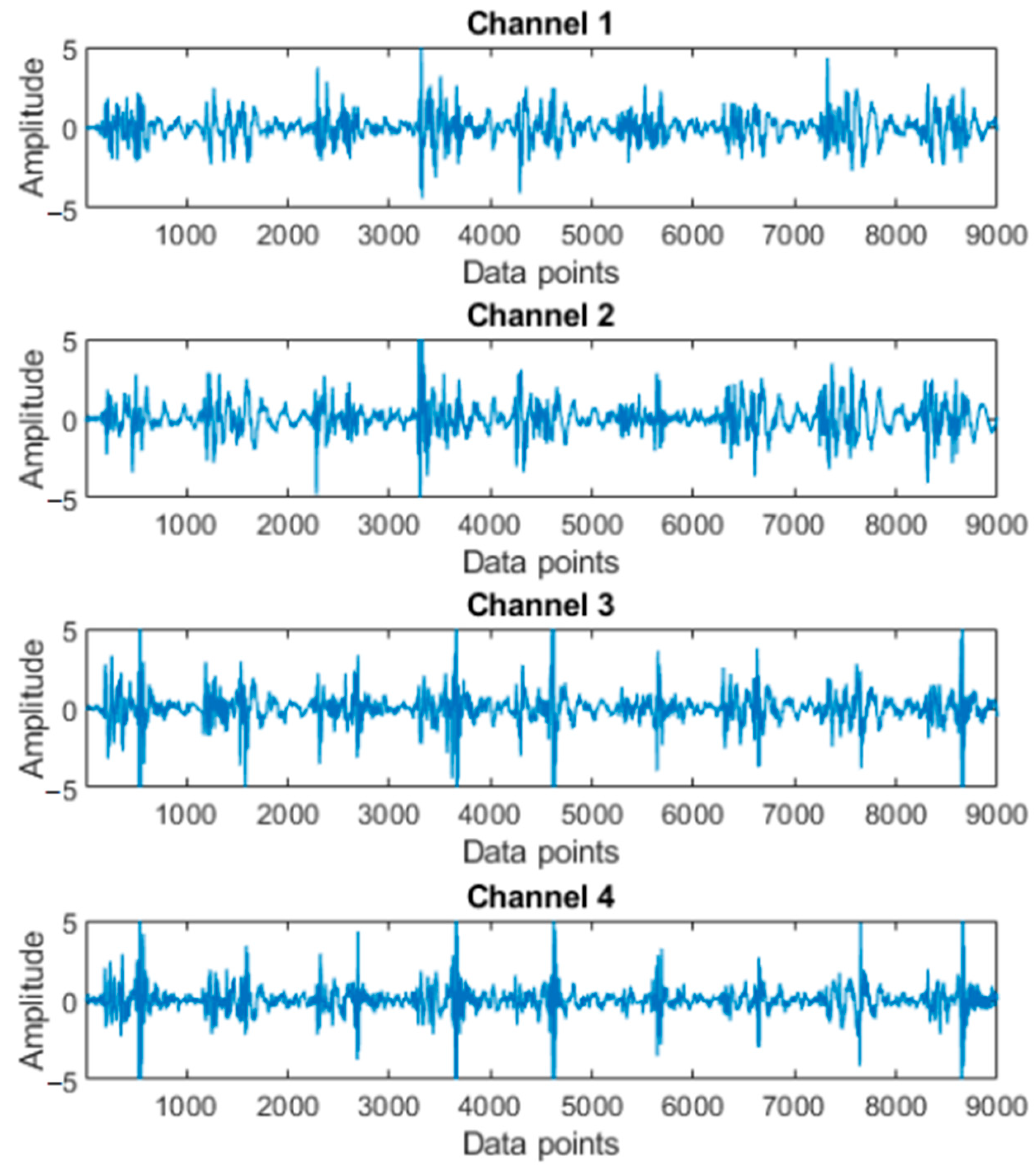 Mechanomyography Signal Pattern Recognition of Knee and Ankle Movements ...