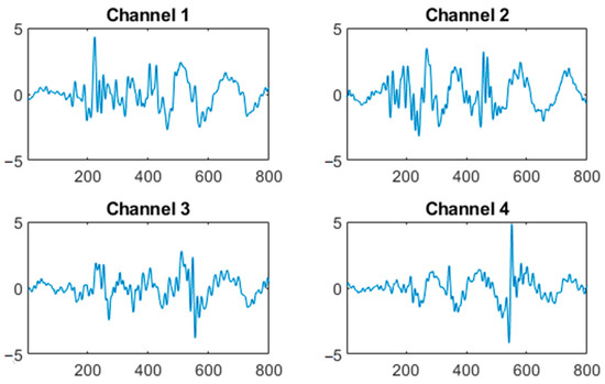 Mechanomyography Signal Pattern Recognition of Knee and Ankle Movements ...